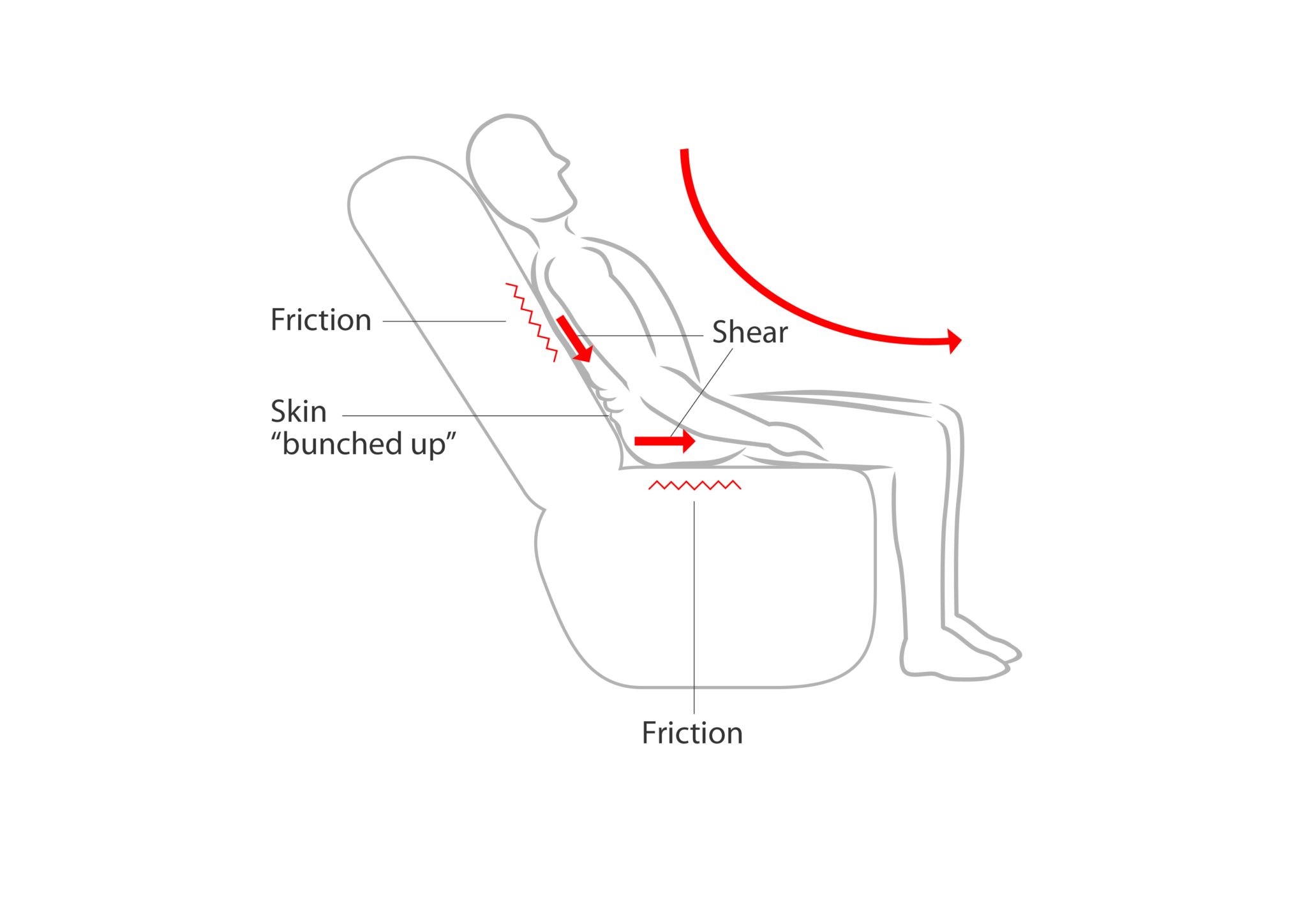 Pressure Care – Why It’s Important – Occupational Therapy